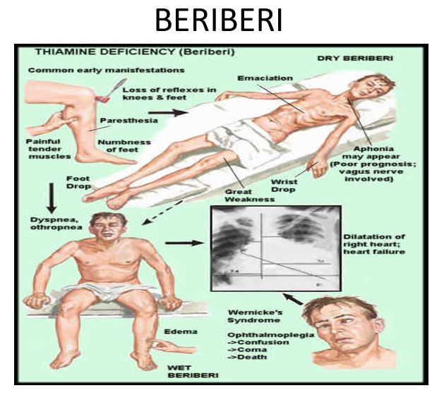 Nutrition and Public Health