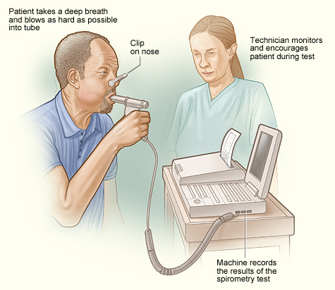 Bronchial Asthma