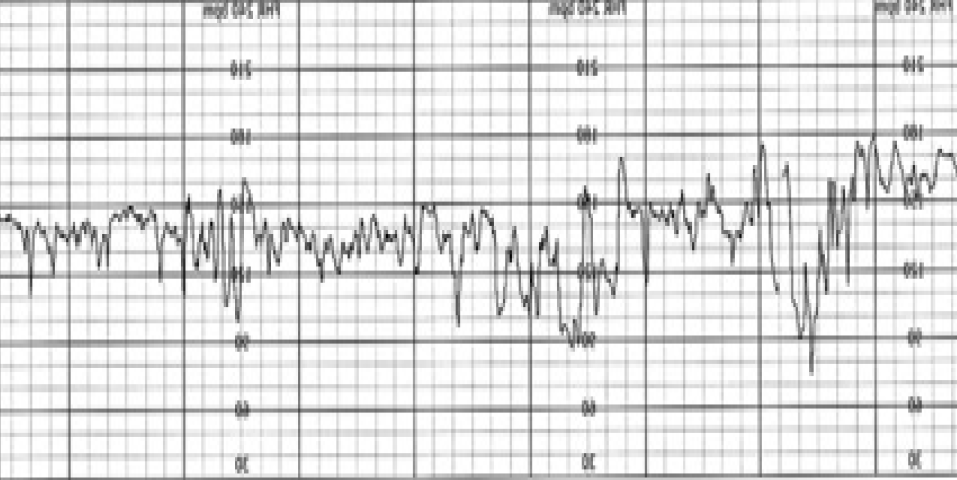 Antenatal Fetal Monitoring