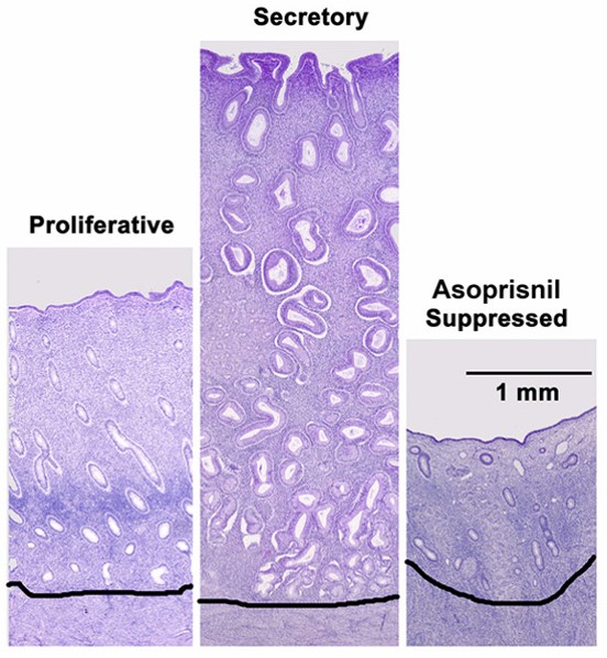 Anatomy of the Female Genital Tracts; Abnormal Development