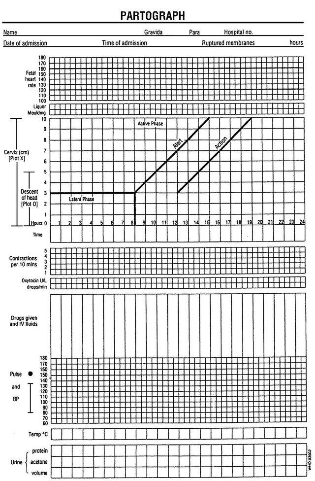 Introduction to Partograph
